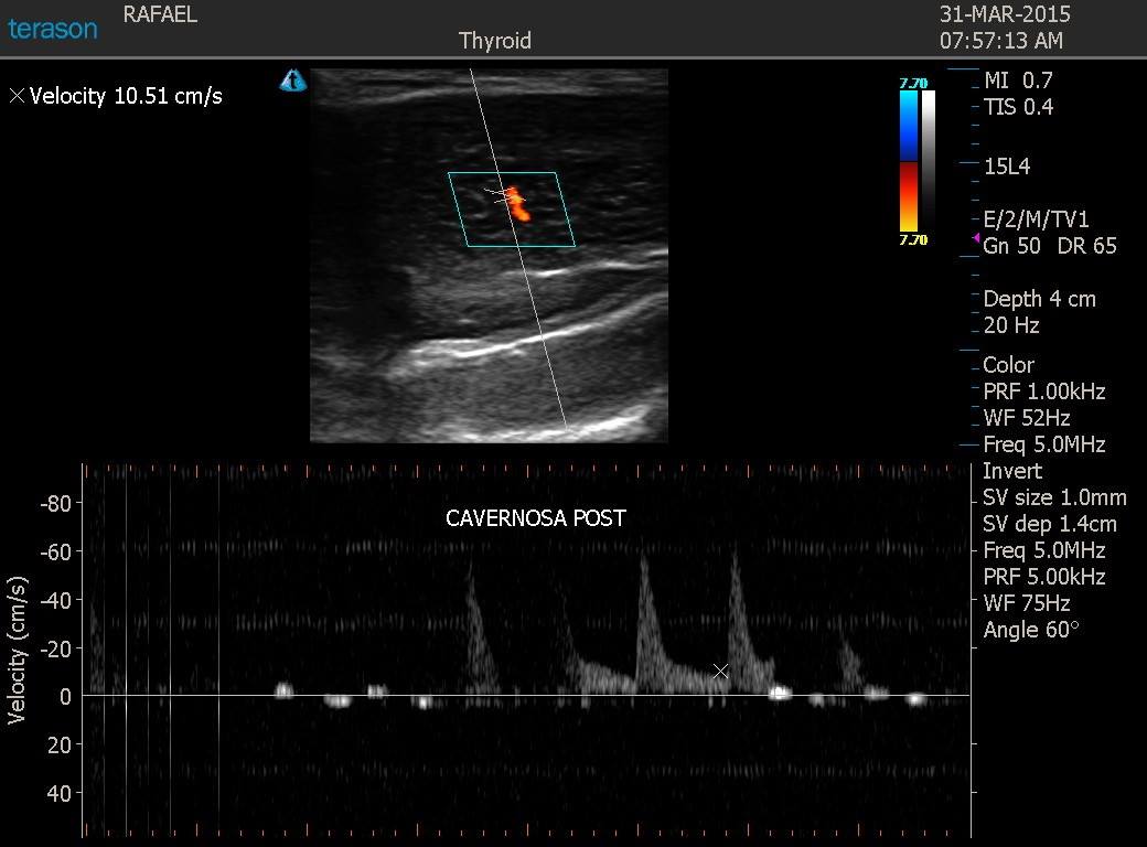 Ultrasonido Vascular SAS - SERVICIOS